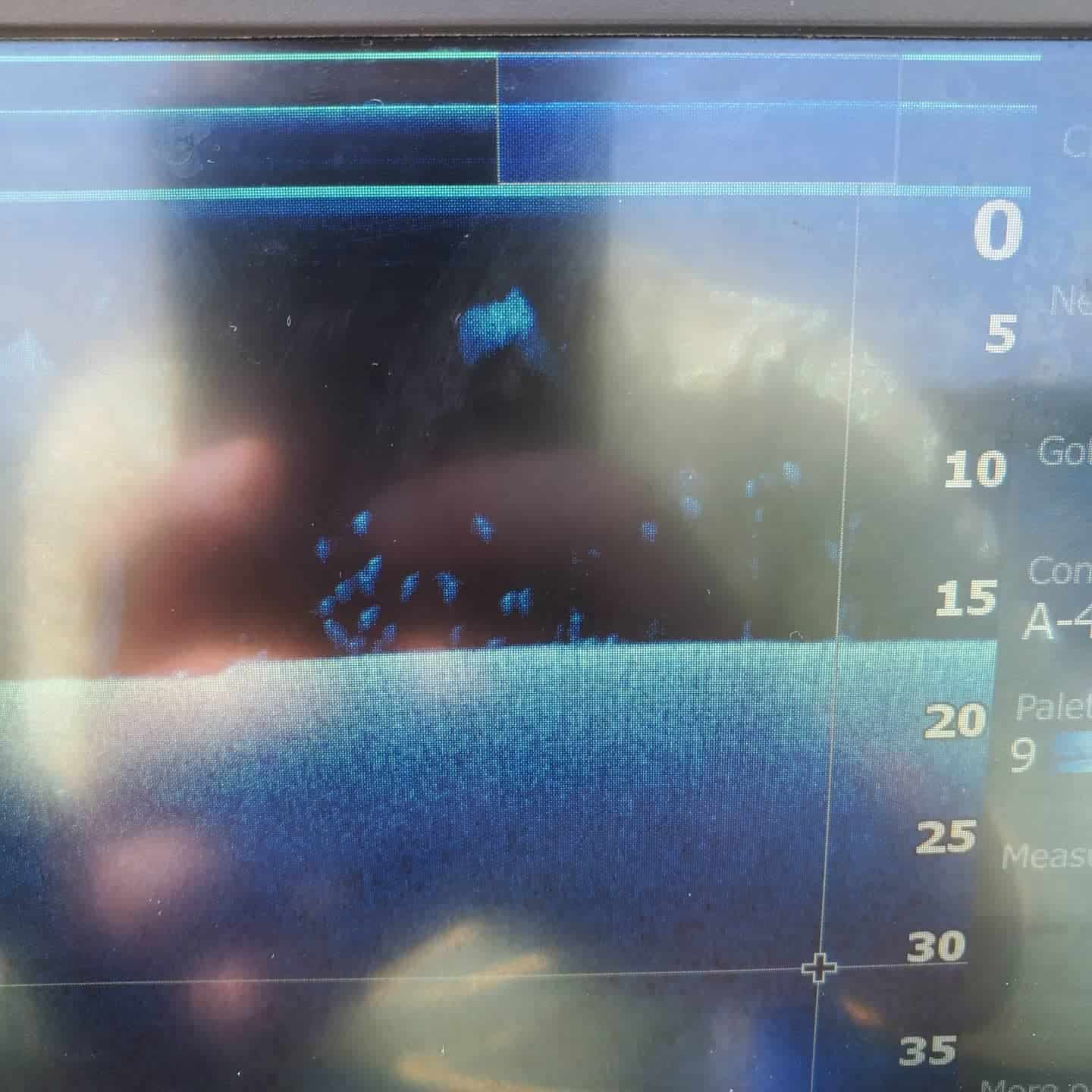 Everything You Need to Know About Fishing Points (2026) - Bass Blog